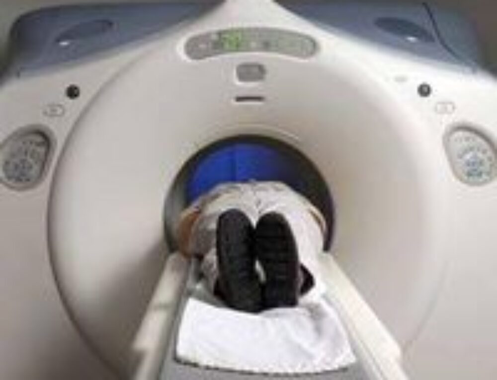 Hvad er Medicinrådet? – Prostatakræftforeningen